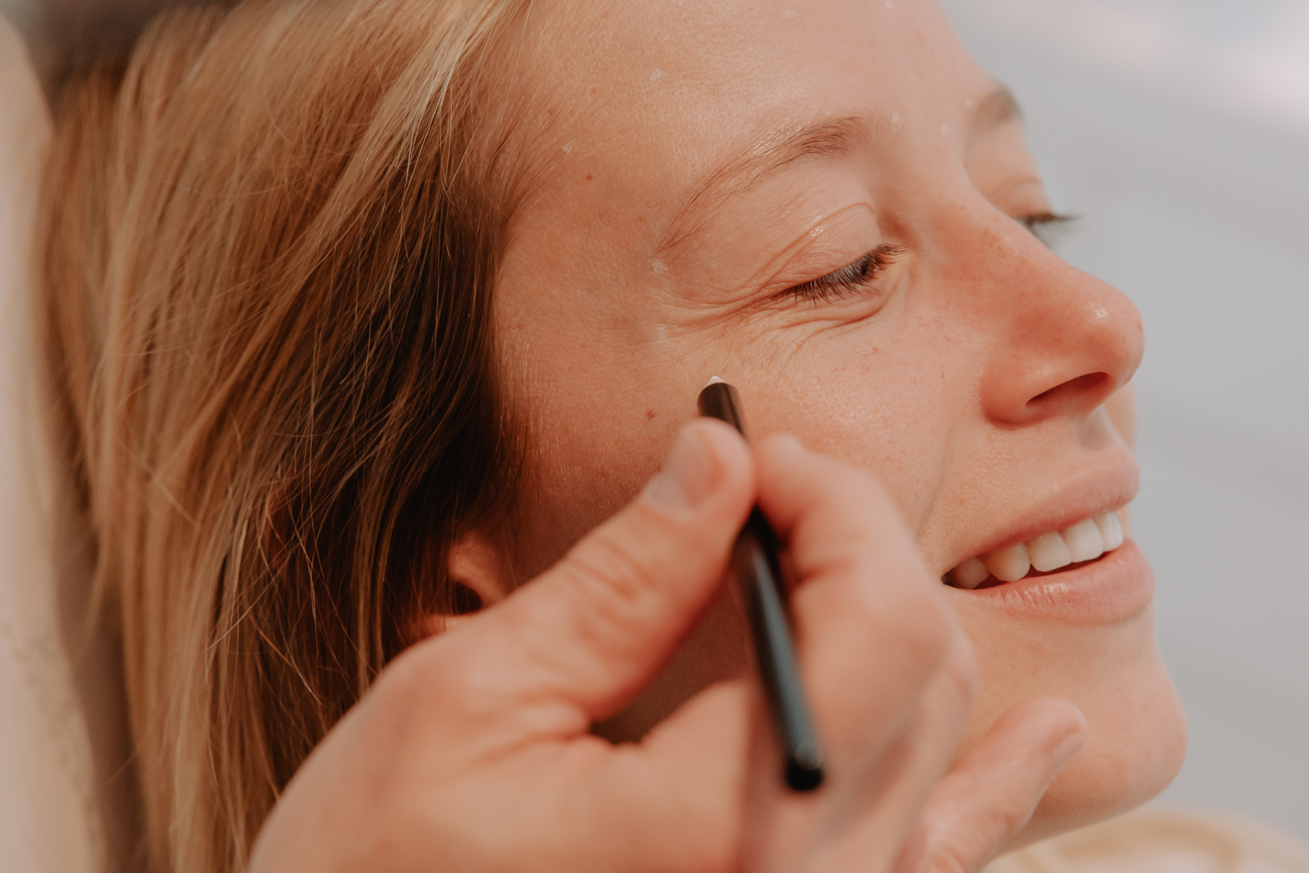 Kraaienpootjes behandelen | Botulinetoxine rond de ogen – Skinject ...